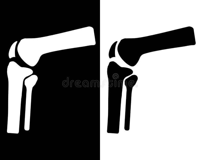 Knee injury stock vector. Illustration of healthcare - 97481053