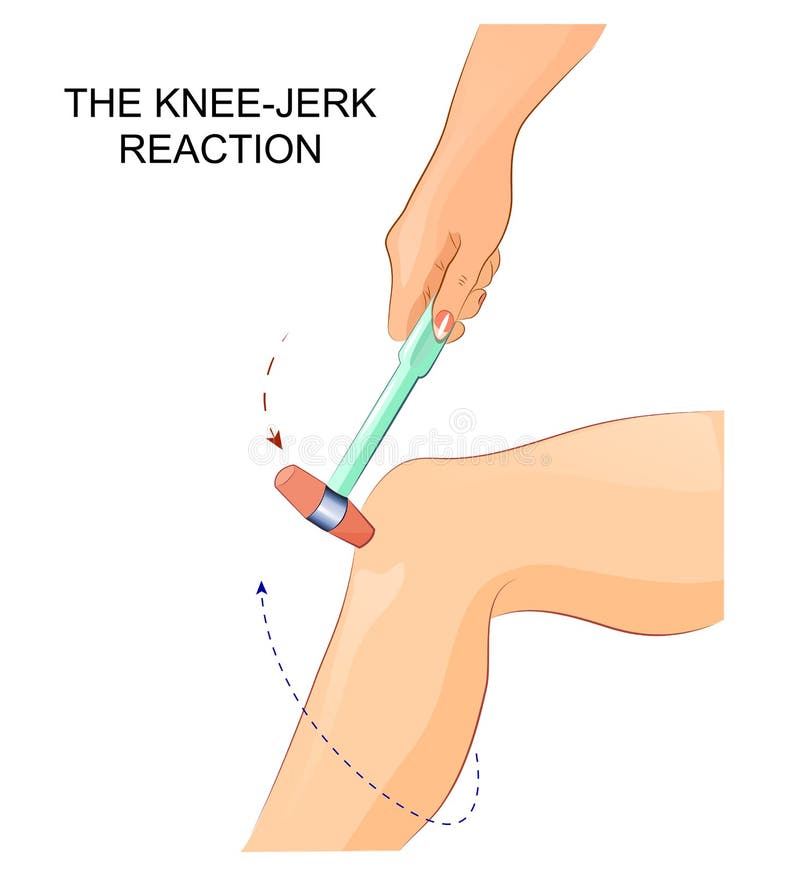 Spinal Reflex Arc Anatomical Scheme, Vector Illustration, with Stimulus ...