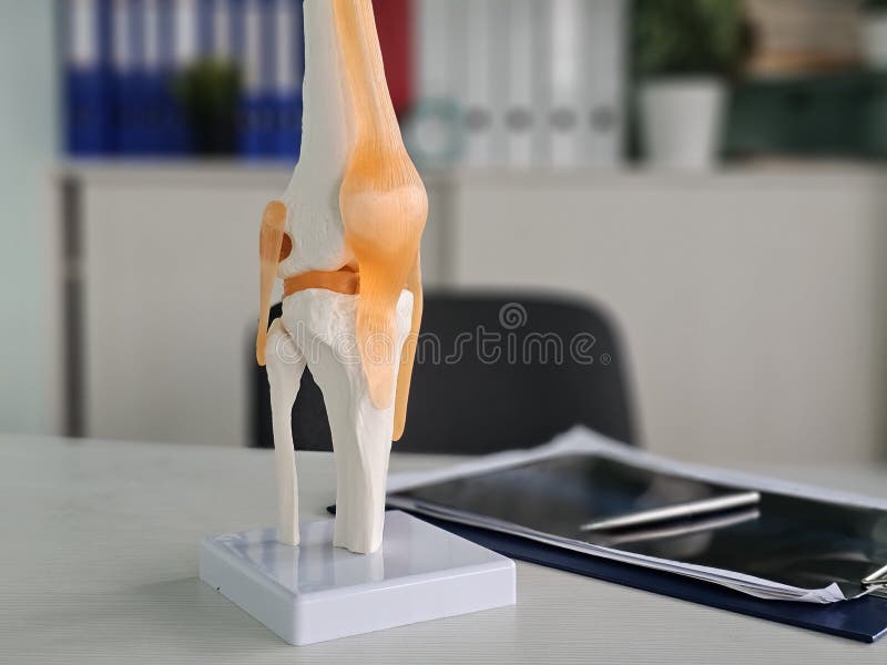 Knee Joint Model Displayed on a Desk in a Medical Office during a ...