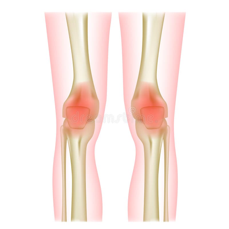 Knee Joints. Human Leg Bones Stock Vector - Illustration of joints ...