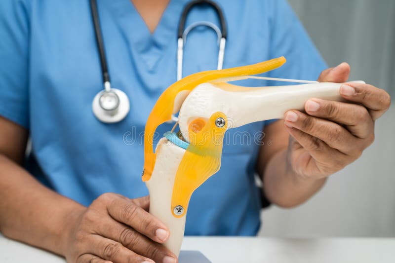 Knee Osteoarthritis, Doctor Showing Model Knee Joint Orthopedic Stock ...