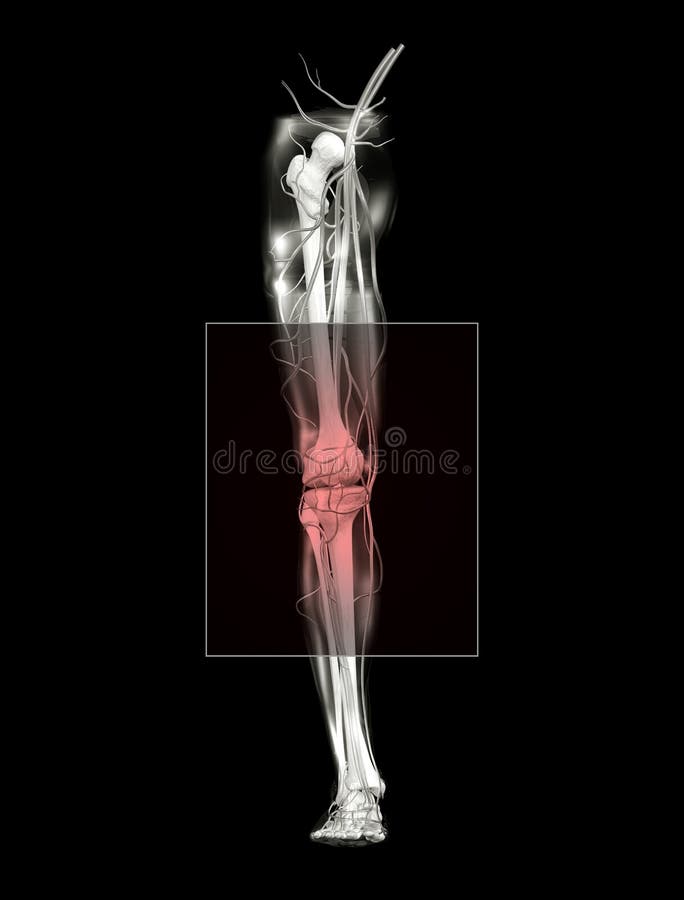 Knee Pain, Front View stock illustration. Illustration of artery - 3022270
