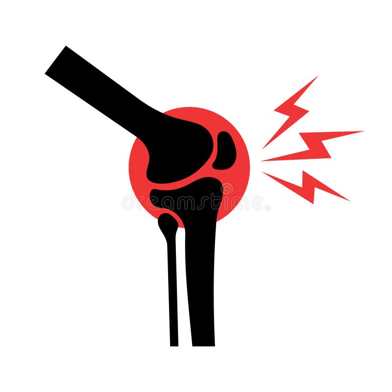 Knee Pain Icon in Flat Style. Vector. Stock Vector - Illustration of ...