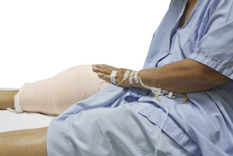 Knee replacement incision stock image. Image of hospital - 28004671