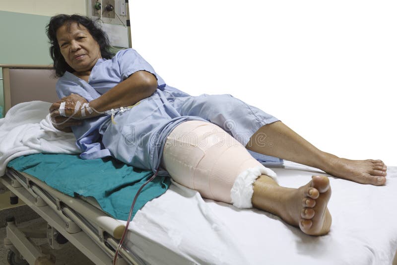 Knee replacement incision stock image. Image of healthcare - 28004581