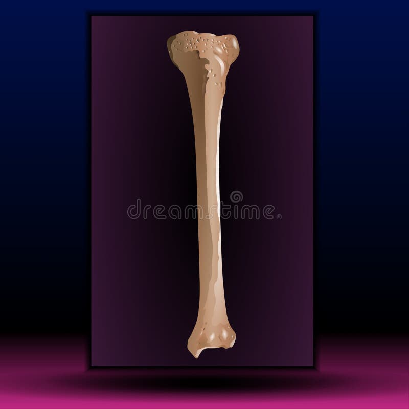 Knochenmark Menschliche Knochenstruktur Vektorgrafik Stock Abbildung ...