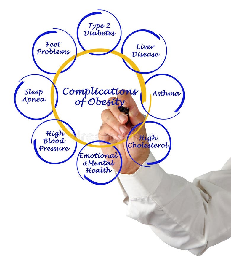 Komplikationen Von Korpulenz Stockfoto - Bild von schlaf, asthma: 85632896