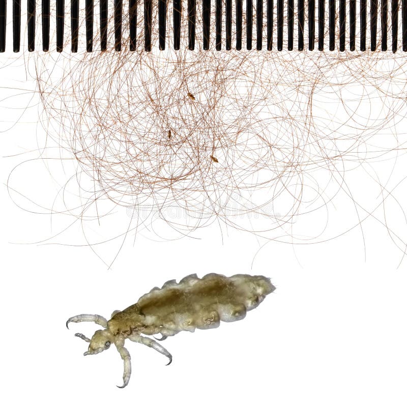 Kopflaus - Pediculus Capitis, Mikroskopbild Stockfoto - Bild von saugen ...
