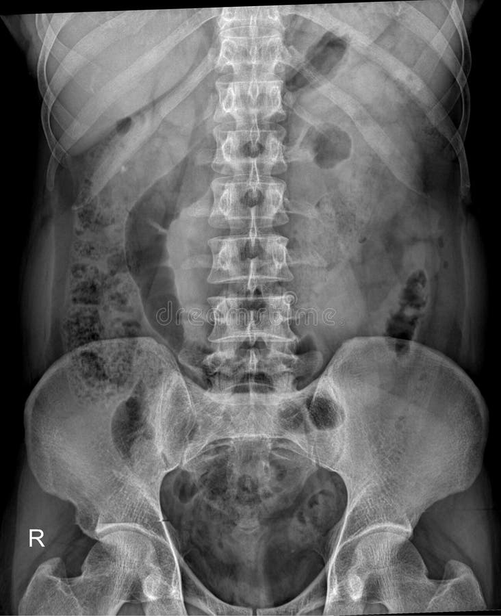 Kidney Bladder Spine Stock Photos - Free & Royalty-Free Stock Photos ...