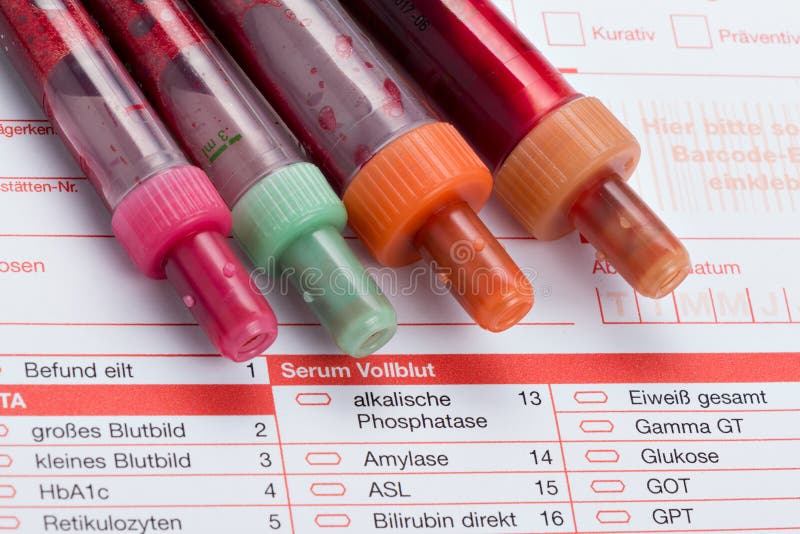 L'analyse De Sang, Prises De Sang Sur Un Laboratoire Forment Photo ...