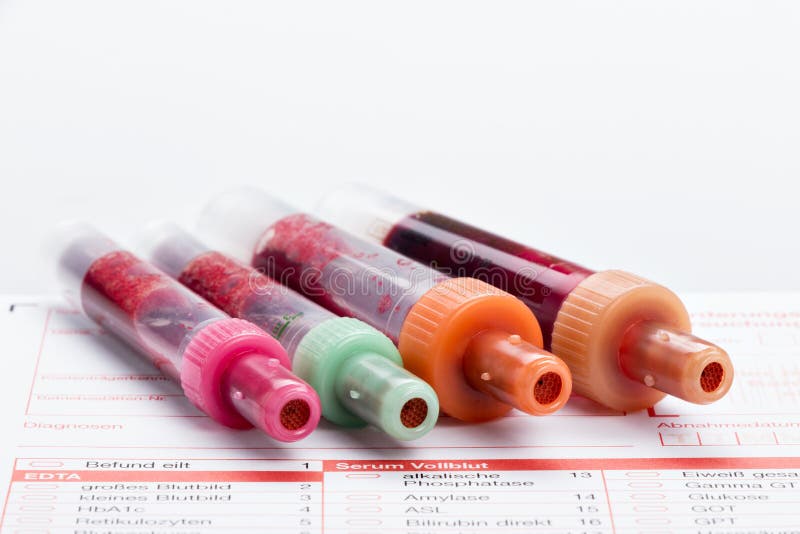 L'analyse De Sang, Prises De Sang Sur Un Laboratoire Forment Image ...