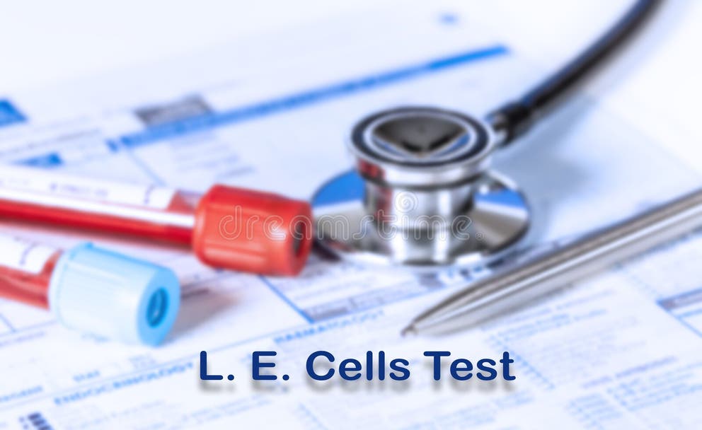 L. E. Cells Test Testing Medical Concept Stock Image - Image of concept ...