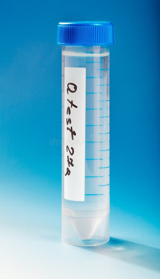 L'eau dans un essai photo stock. Image of verrerie, tube - 39341936