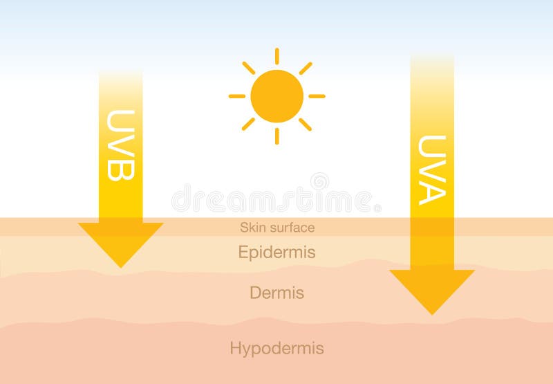 La Differenza Di Radiazione 2 Scrive Al Sole Con Pelle Illustrazione ...