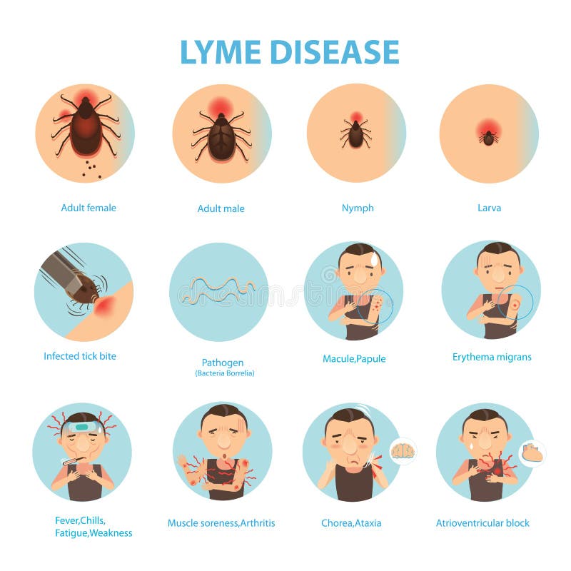 La Maladie De Lyme, Borreliosis Ou Borrelia Illustration de Vecteur ...