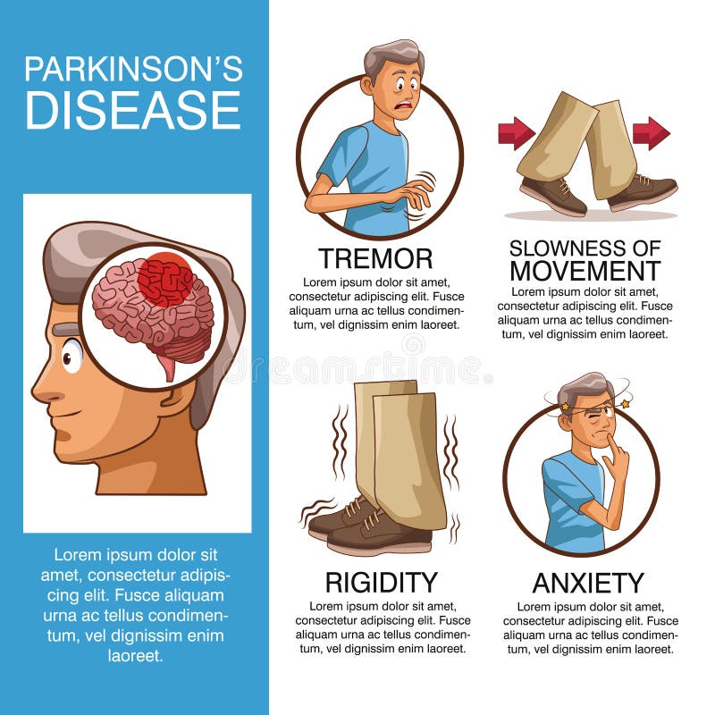 La Maladie De Parkinsons Infographic Illustration de Vecteur ...