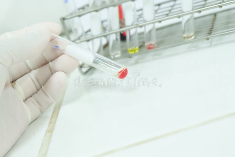 Lab blood bank in white. stock image. Image of background - 90549405