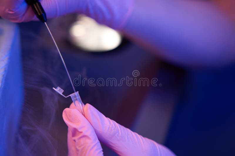 Lab Scientist Preparing Biological Specimens for Cryopreservation Stock ...