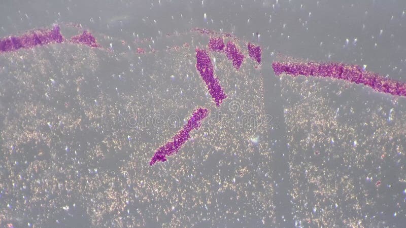 Lab Slide with Three Types of Bacteria Magnified in 100 Times Under ...