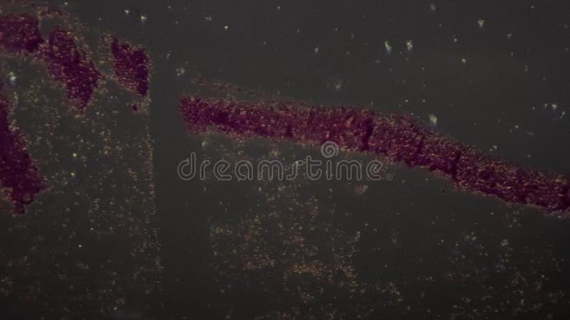 Three Types of Bacteria are Filmed Under Microscope Against Bright ...