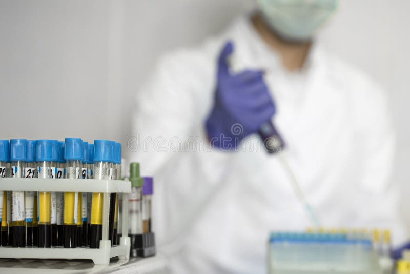 Lab Technician Analyzes Blood Test in Laboratory. Focus on Blood ...