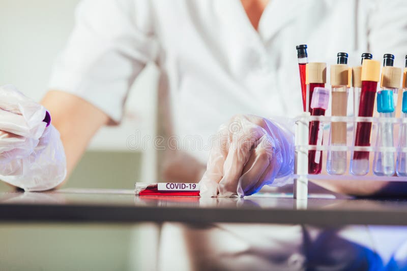 Lab Technician Assistant Analyzing a Blood Sample in Test Tube at ...