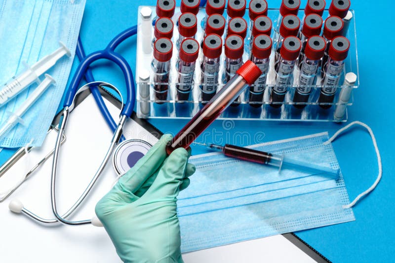 Lab Technician Assistant or Doctor Holding a Blood Sample in Test Tube ...