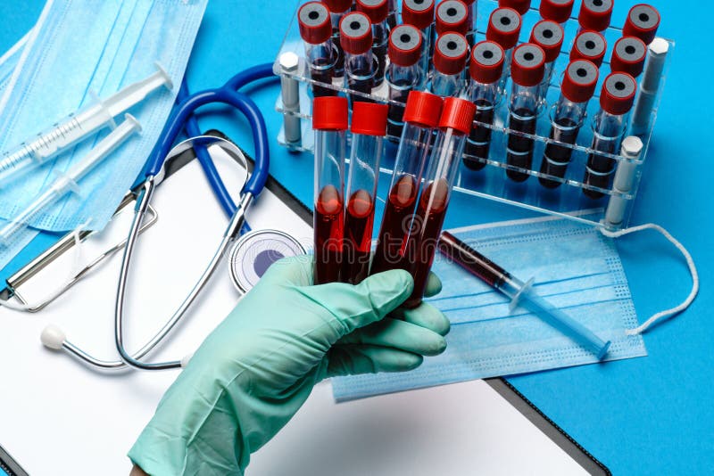 Lab Technician Assistant or Doctor Holding a Blood Sample in Test Tube ...