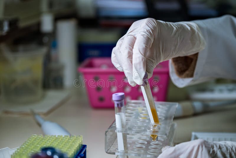 Lab Technician Doing a Chemical Test Stock Photo - Image of analyzing ...