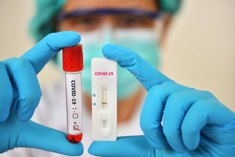 Lab Technician Holding HIV Rapid Device Test Stock Image - Image of ...