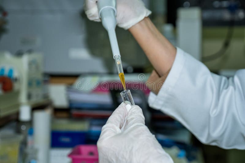 Lab Technician with a Sample of Plasma Blood Analyzing the Results ...