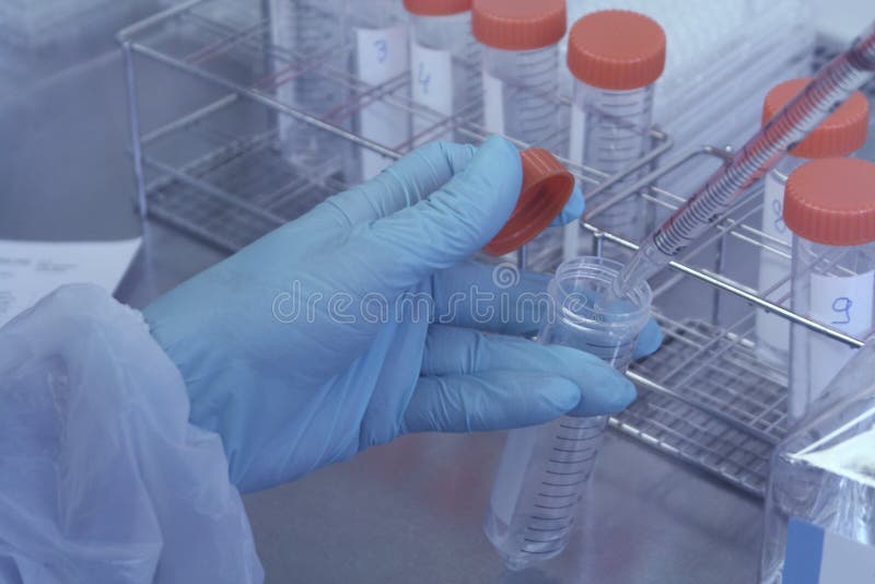 Lab Technician Takes Sample from Test Tube for Test Stock Photo - Image ...