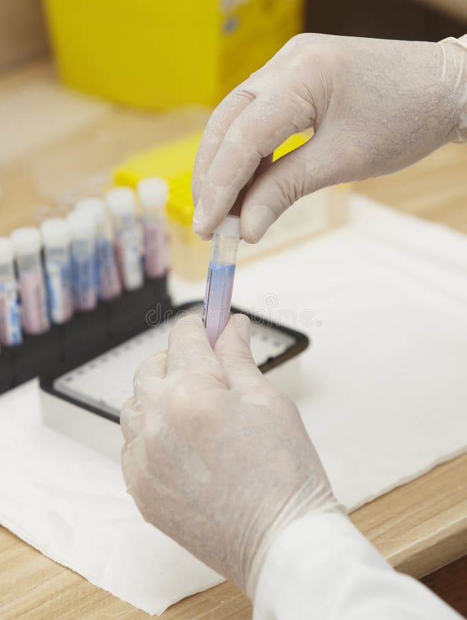 Lab Test Medicine Health Care Stock Image - Image of drug, equipment ...