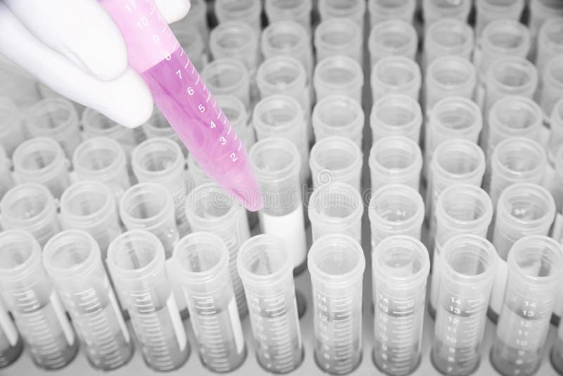 Lab Worker Adding Pink Liquid To Containers in Laboratory Stock Photo ...
