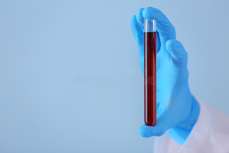 Lab Worker Holding Test Tube With Blood Sample On Color Background ...