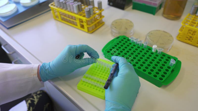 Labeling Tubes of Bacterial Colonies for Sowing on Solid Nutrient Media ...