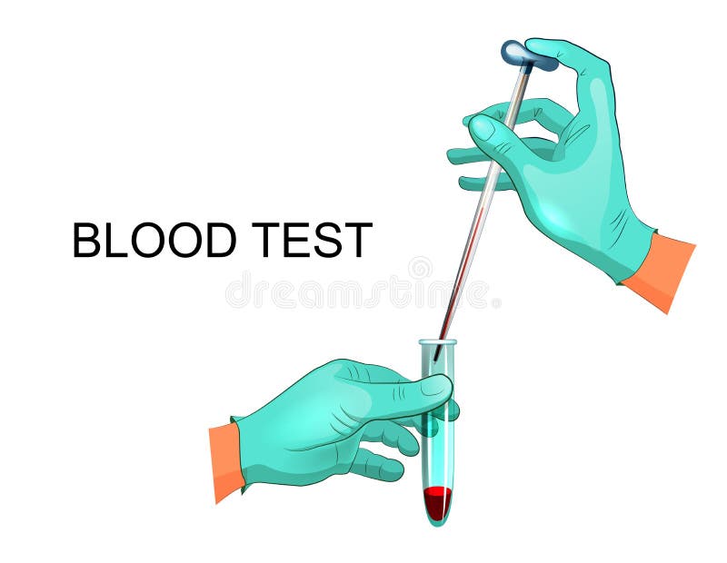 Laboranalyse Einer Biologischen Probe Stock Abbildung - Illustration ...