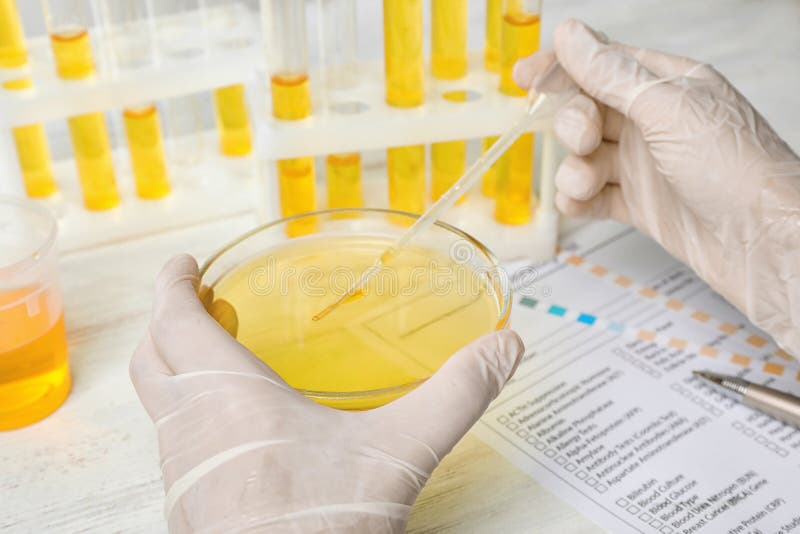 Laborant, Der Glas Mit Urin Nahe Tabelle Hält Urologiekonzept Stockfoto ...