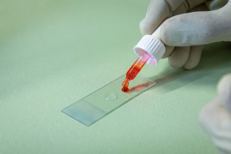 Laboratory Analysis with Red Liquid on Microscope Slide. Stock Image ...