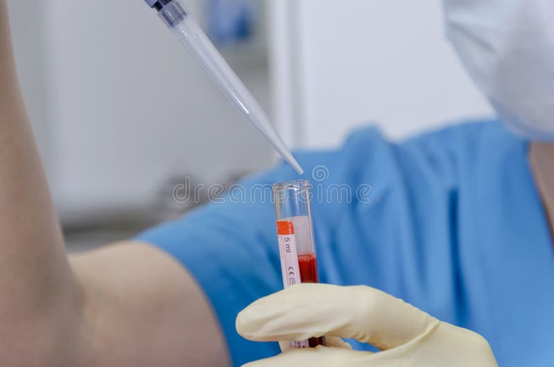 Blood Sample Pipette Lab Stock Photos - Download 1,082 Royalty Free Photos