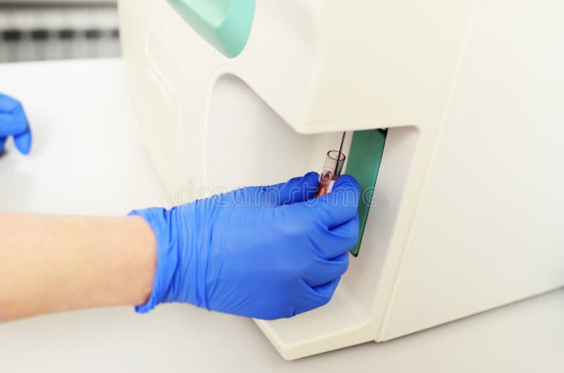A Laboratory Assistant Examines a Blood Sample in an Analyzer in a ...