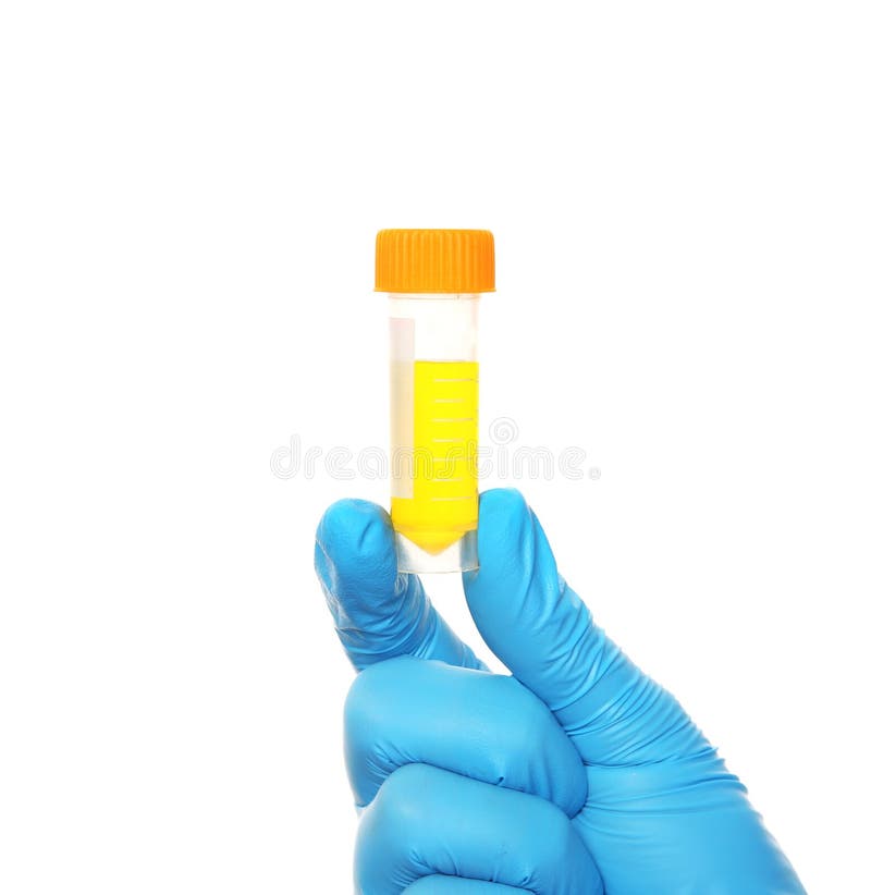 Container with Urine Sample on Table in Laboratory, Space for Text ...