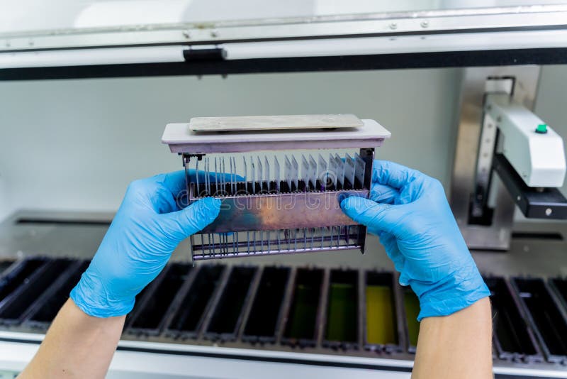 Laboratory Assistant Works with Automatic Multi Slides Stainer at the ...