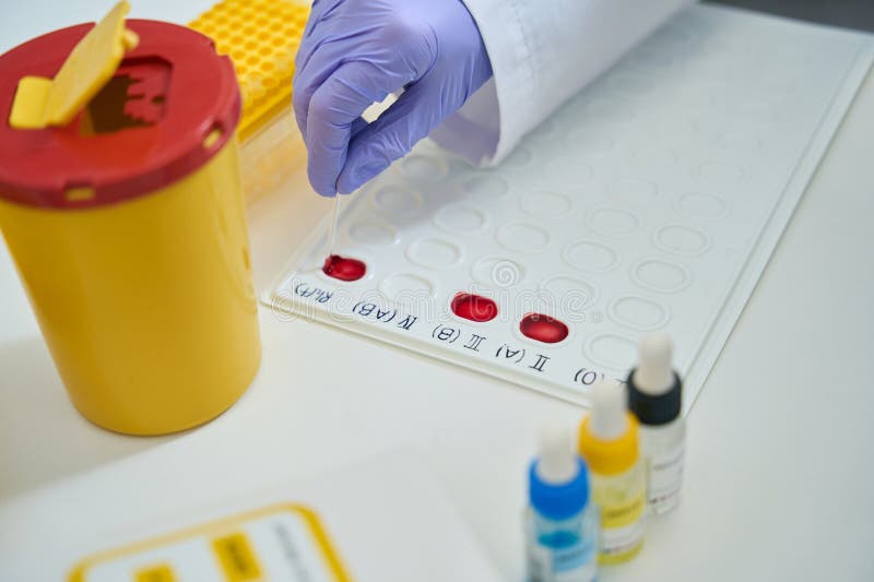 Laboratory Assistant Works with Blood Samples on an Indication Palette ...