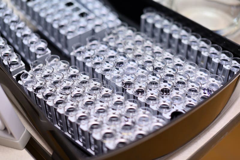 Laboratory Containers with Analyzes for Medical Research Stock Image ...