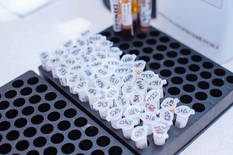 Laboratory Containers with Analyzes for Medical Research Stock Image ...