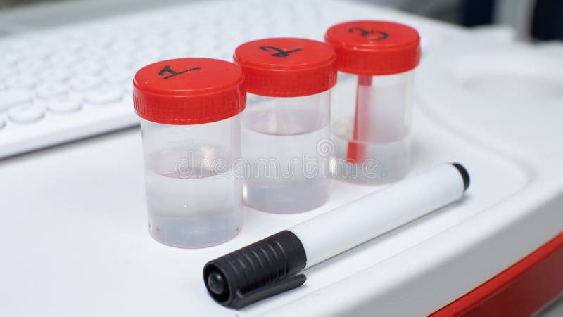 Laboratory Containers for Collecting Biological Material for Research ...