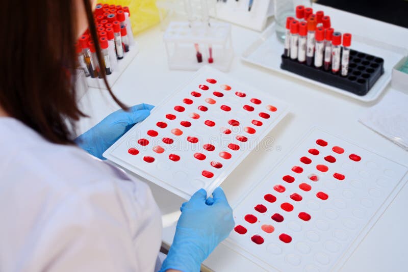 Laboratory Determination of Blood Type. Blood Test Stock Photo - Image ...
