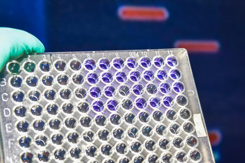 Laboratory DNA testing stock image. Image of biotechnology - 157018651