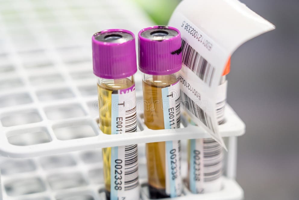 Laboratory Doing Tests for Vaccine Blood Extraction and Analytical ...